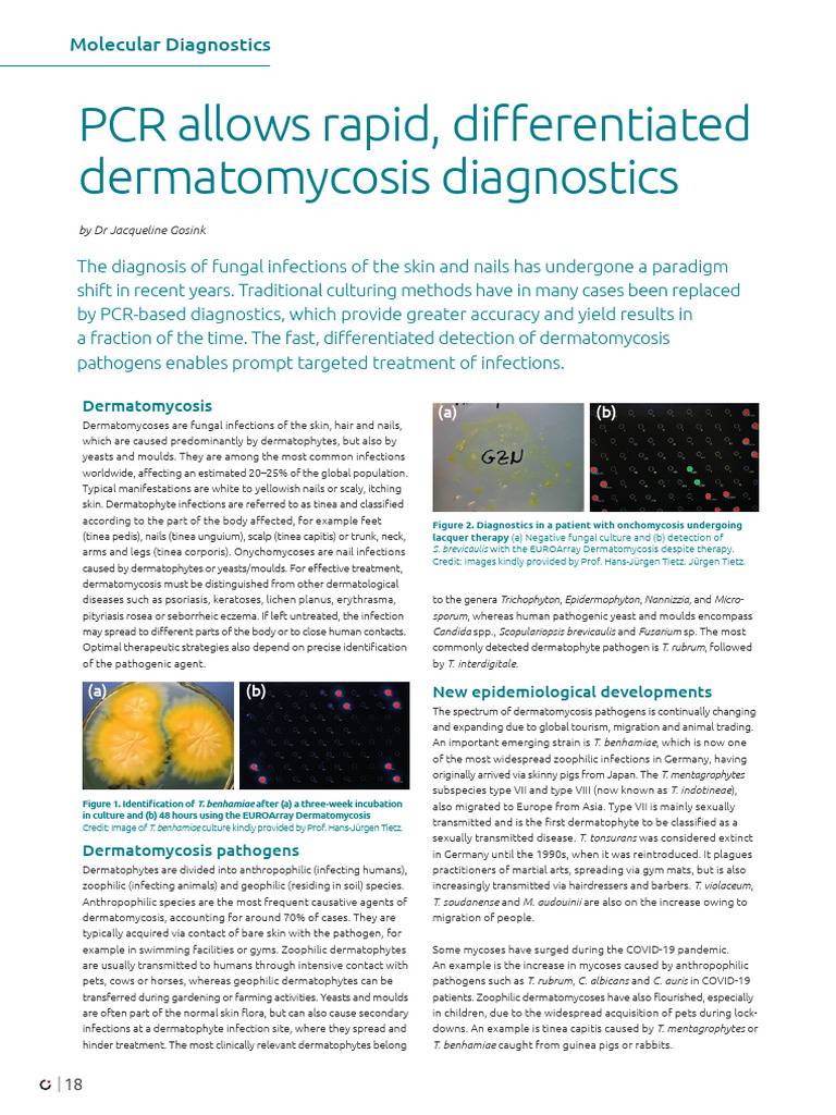 Dermatomycosis CLI Mai2022 | PDF | Infection | Polymerase Chain Reaction