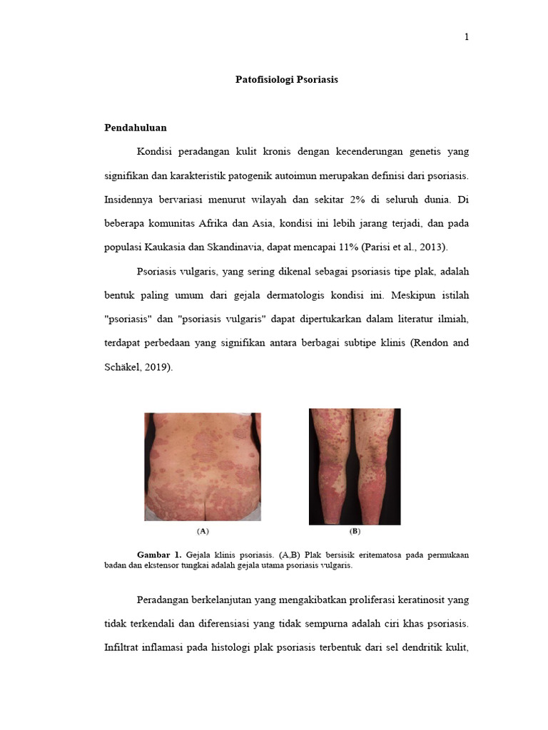 Patofisiologi Psoriasis | PDF