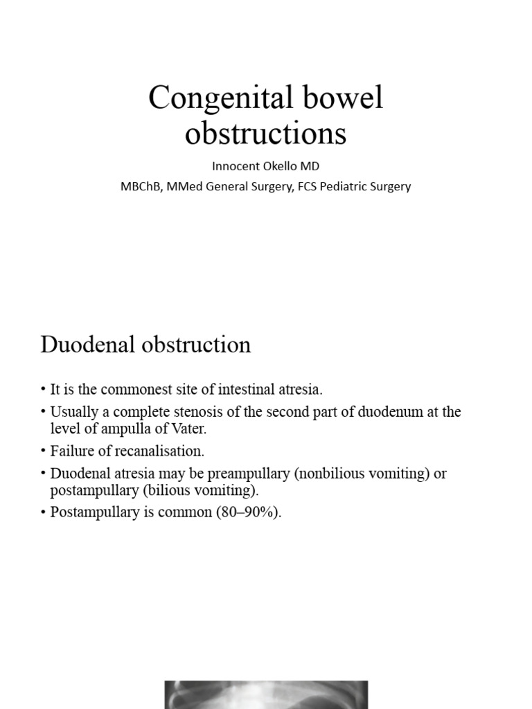 Congenital Bowel obstructions | PDF | Digestive System | Digestive Diseases