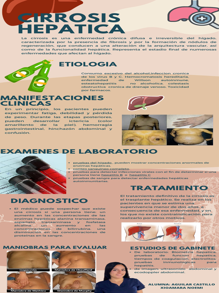 Cirrosis Infografia | PDF | Cirrosis | Hepatitis