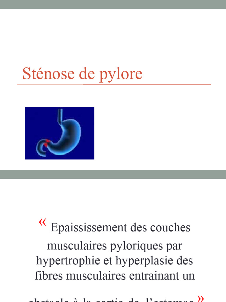 Sténose Du Pylore Pdf _ Sténose Du Pylore Diagnostic – AJRATW