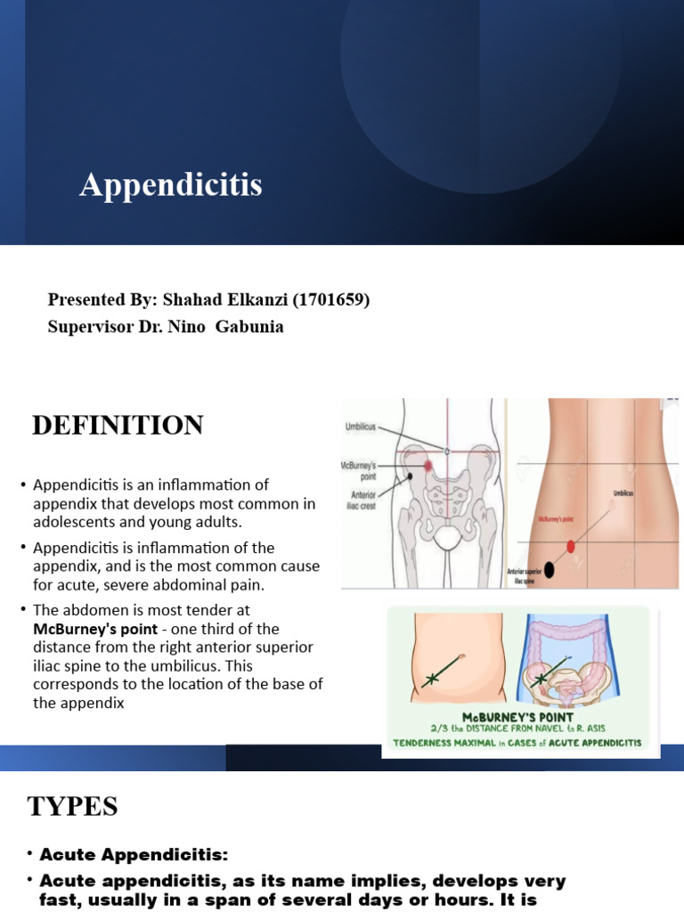 Appendicitis | PDF | Clinical Medicine | Gastroenterology