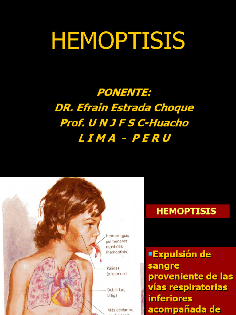 Hemoptisis 2007 | PDF