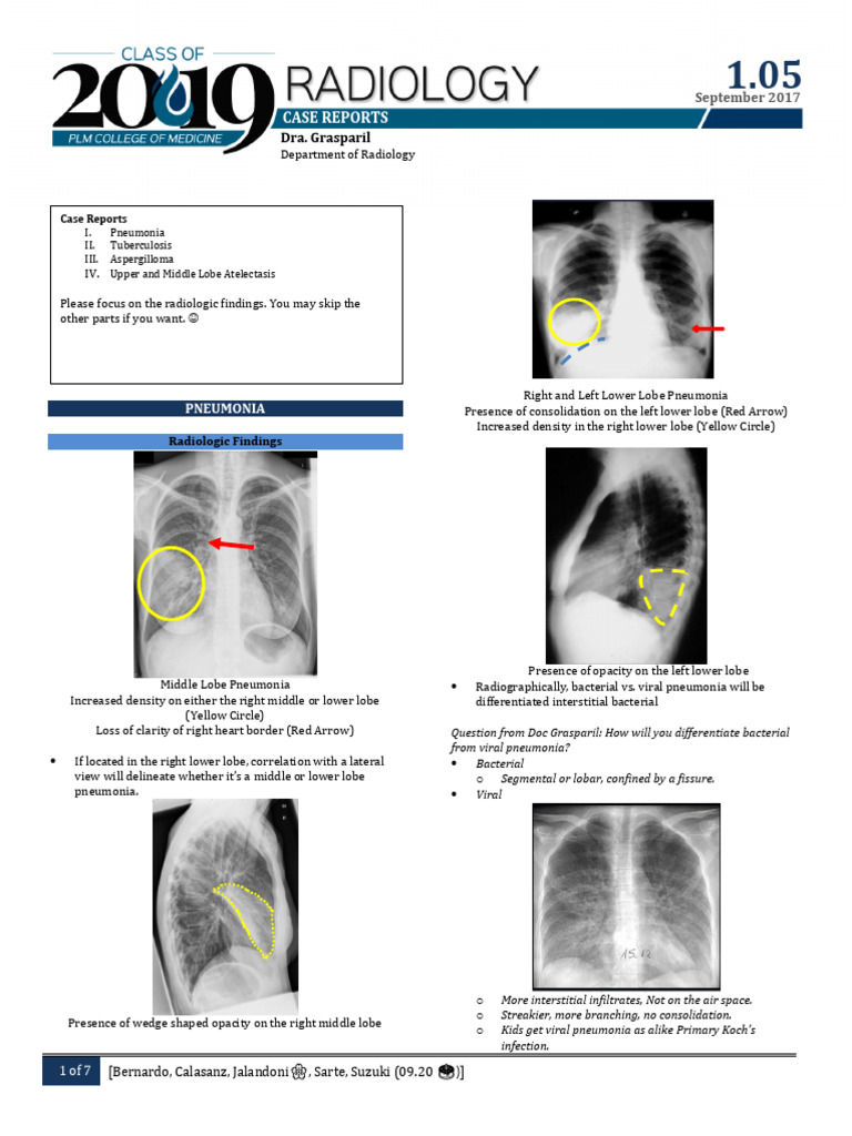 Rad 1.05a Case Reports-1 | PDF | Pneumonia | Lung