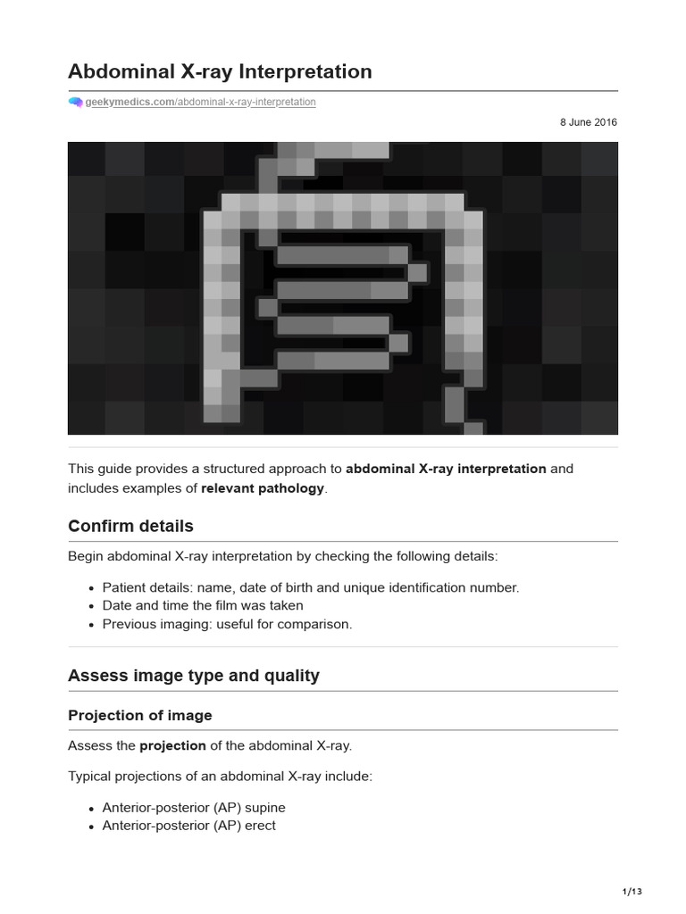 geekymedics.com-Abdominal X-ray Interpretation | PDF | Abdomen | Anatomy