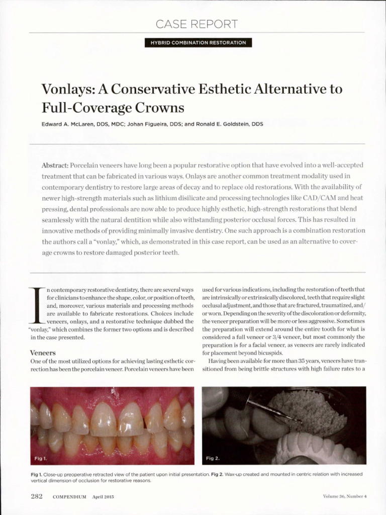 Vonlays 2015 3 | Download Free PDF | Dentistry | Dentistry Branches