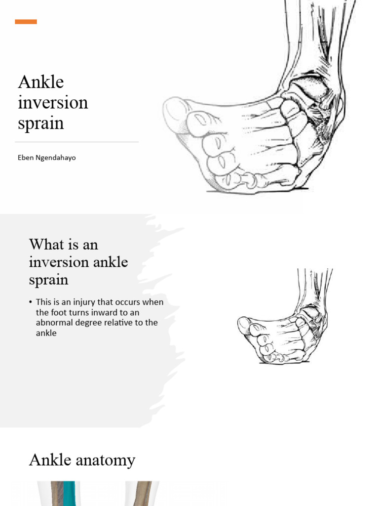 Ankle Inversion Sprain | PDF