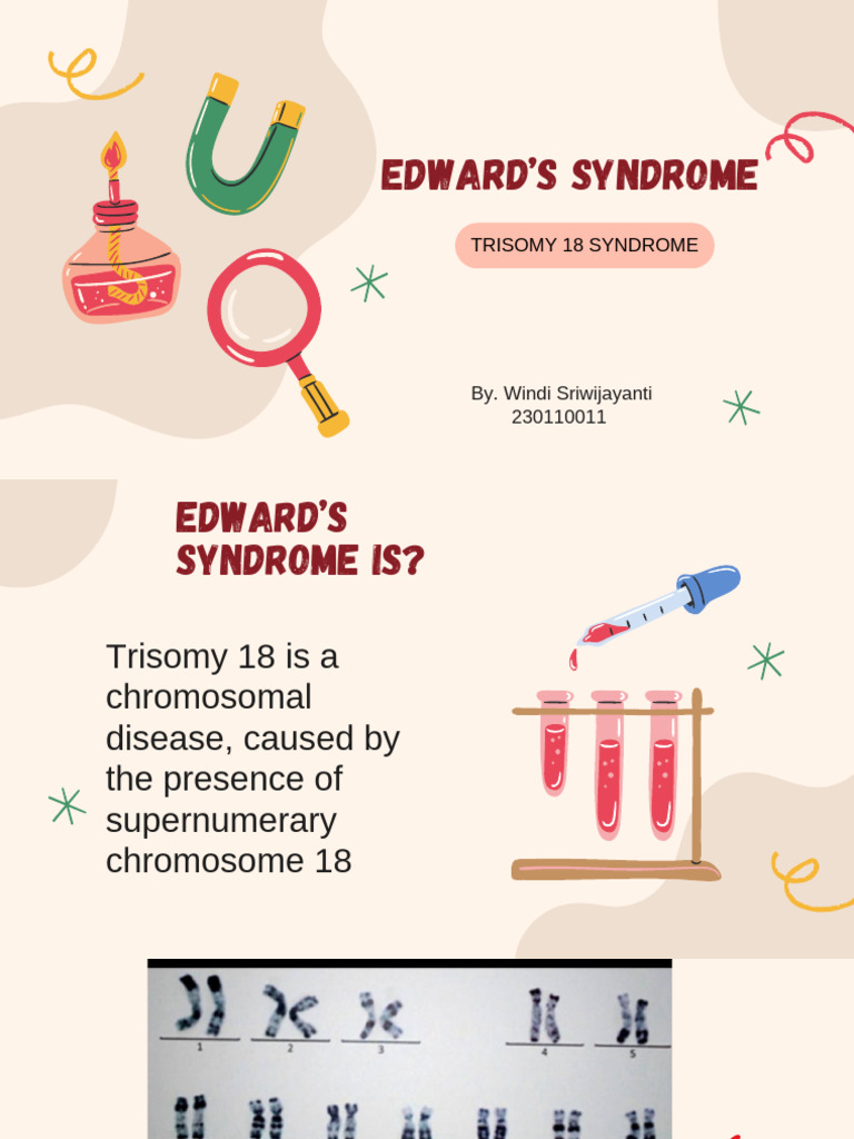 Edwards Syndrome | PDF | Medical Specialties | Epidemiology