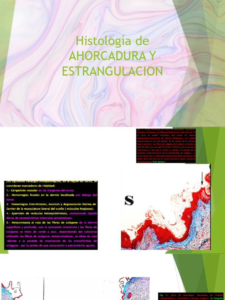 Histología de AHORCADURA Y ESTRANGULACION | PDF