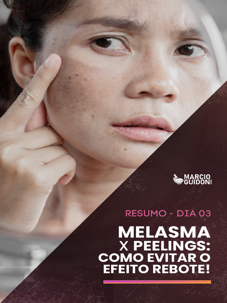 Resumo_Aula_3_Jornada_do_Melasma | PDF | Química
