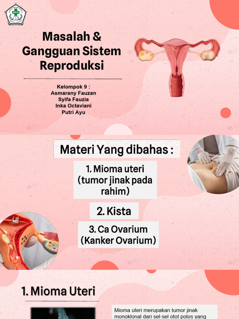 (Kel 9 Mioma, Kista, CA Ovarium | PDF