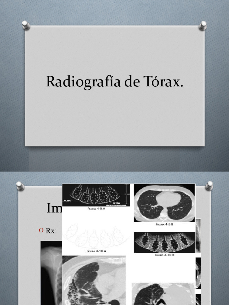 RX Torax | PDF | Especialidades Medicas | Medicina CLINICA