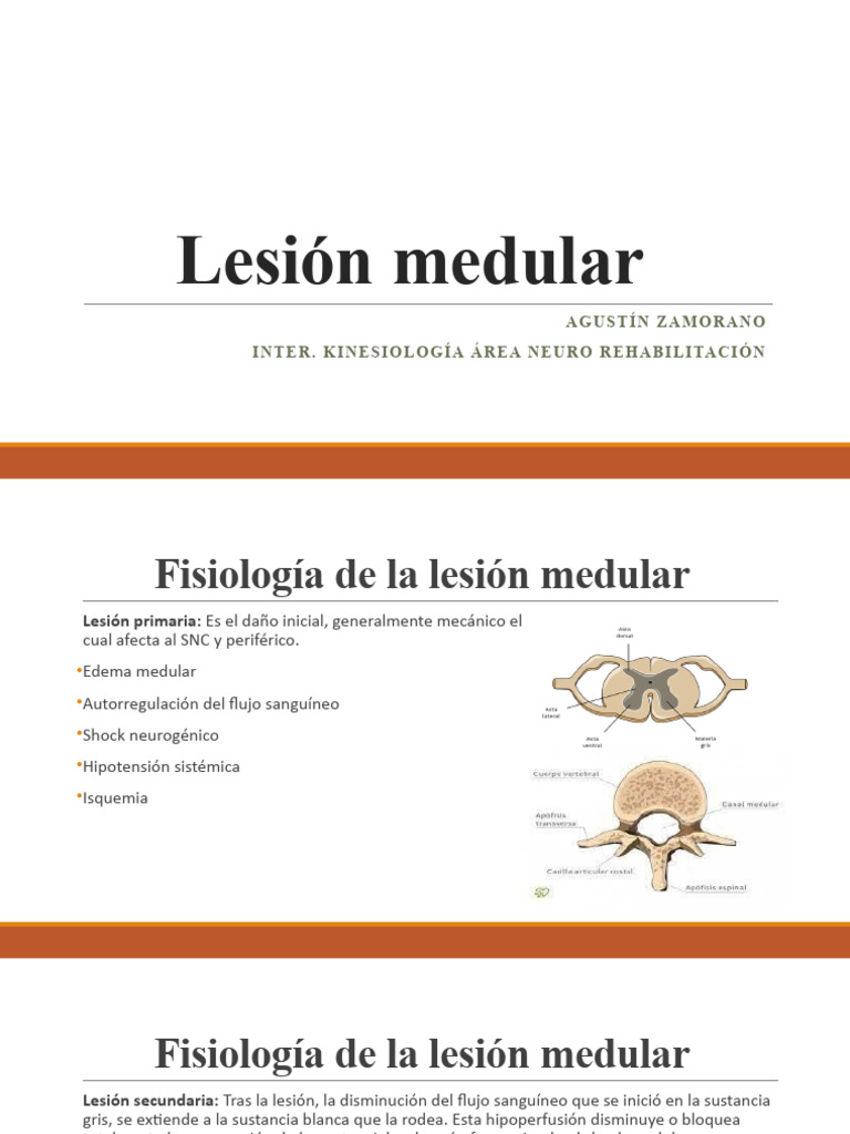 Lesión Medular | PDF
