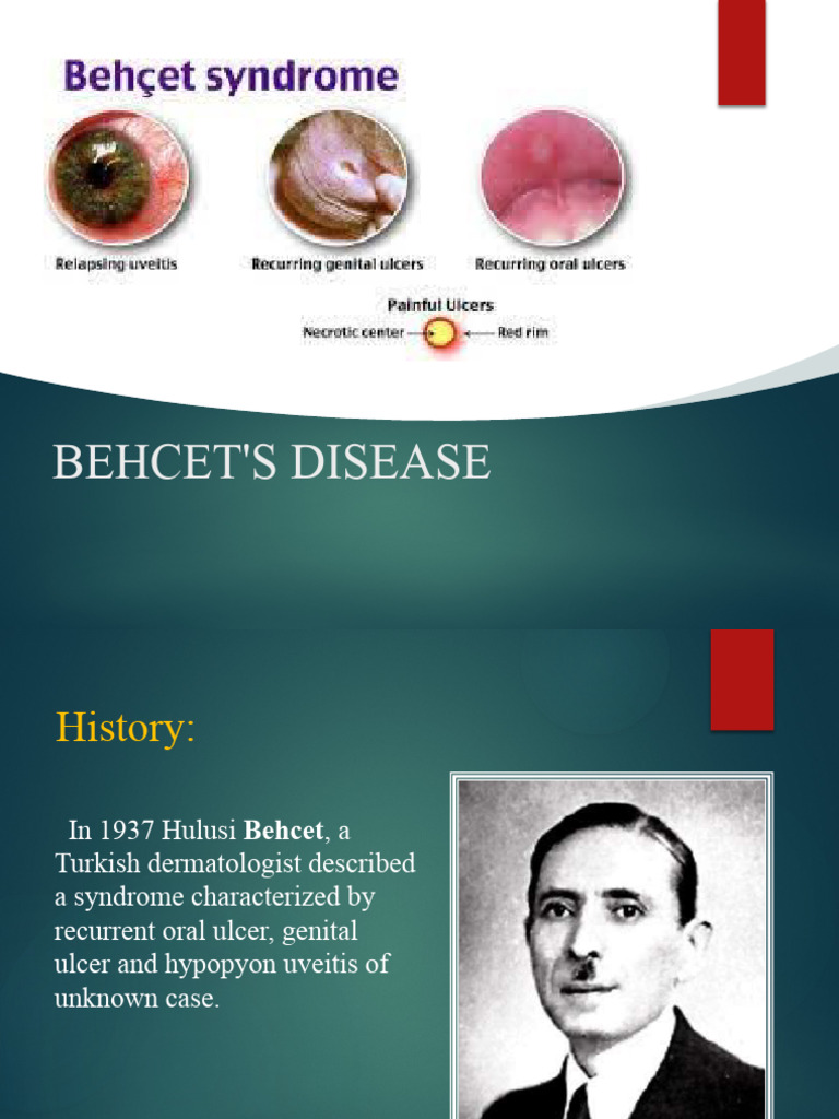 Behcet's Disease | PDF | Diseases And Disorders | Health Sciences