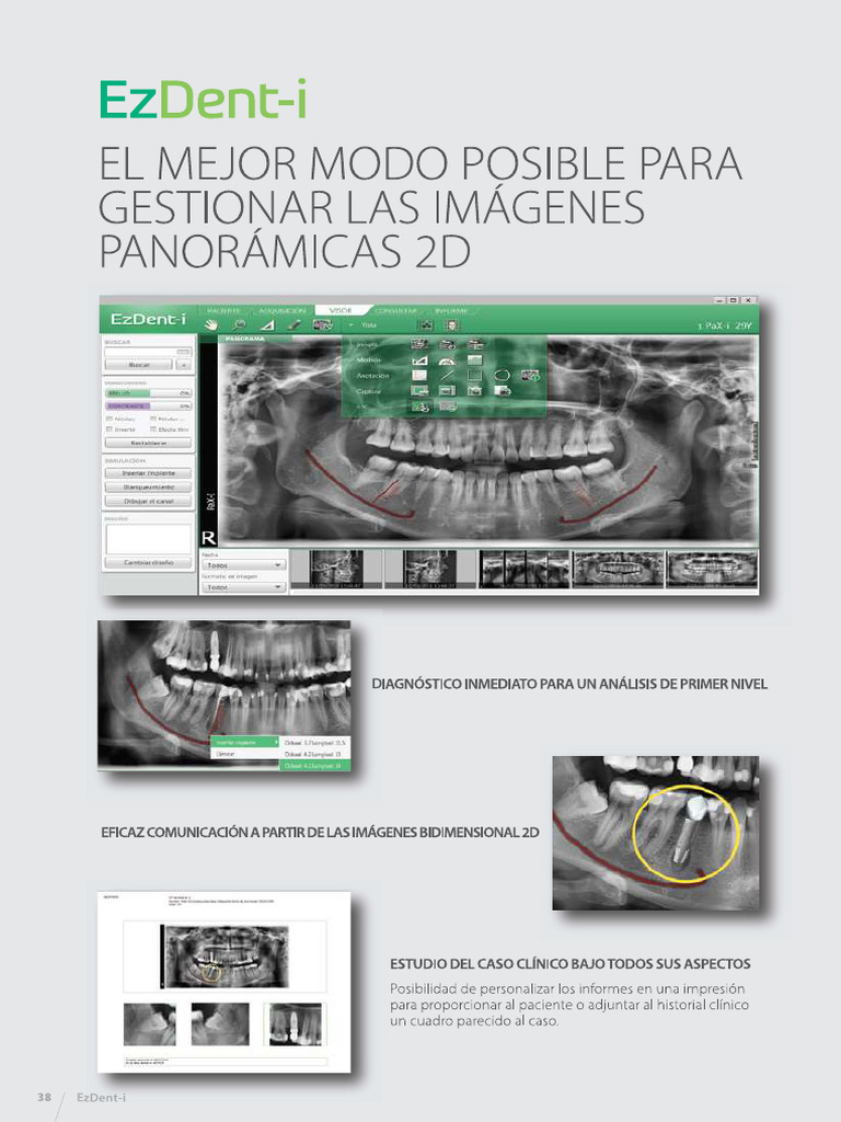 EzDent I Catalogo | PDF