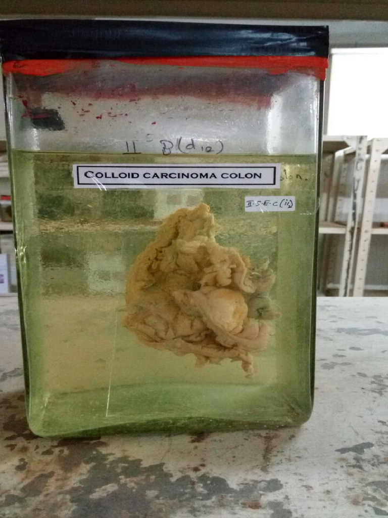 Pathology Spots | PDF