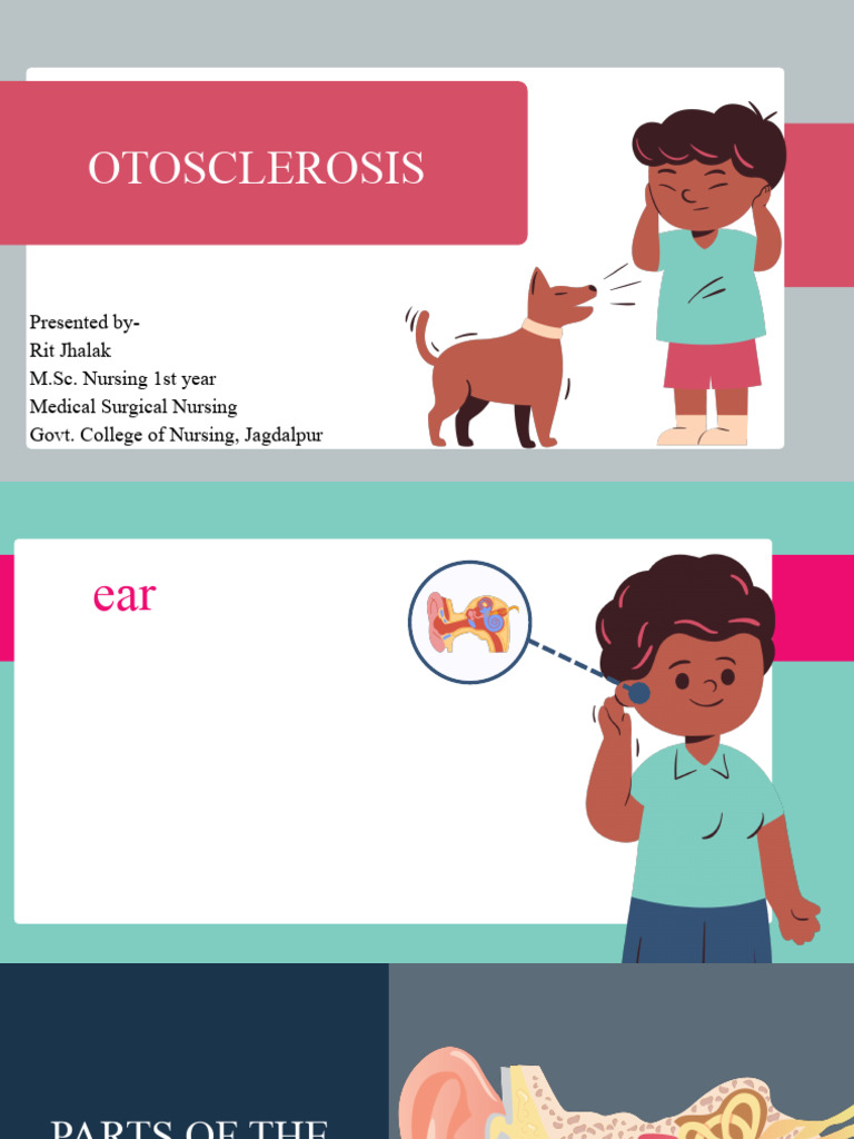 O To Sclerosis | Download Free PDF | Ear | Hearing