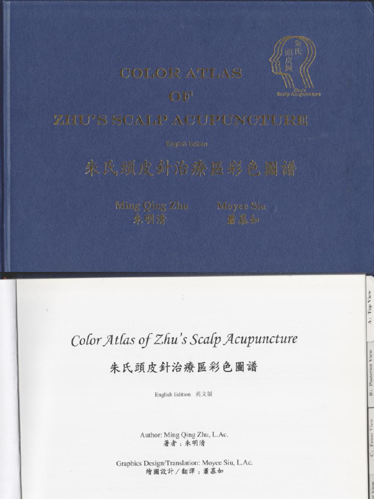 Ming Qing Zhu Color Atlas of Zhux27s Scalp Acupuncture Zhux27s Neuro ...