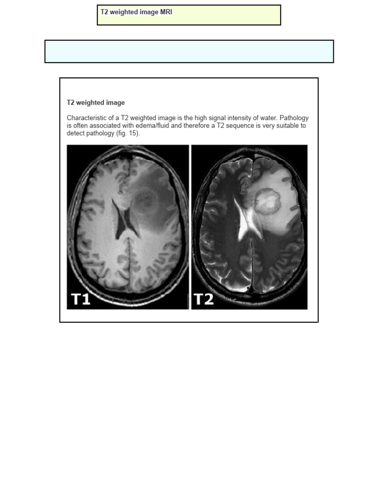 T2 Weighted Image MRI | PDF | Travel