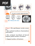 Class II Amalgam Cavity Preparation | PDF | Tooth | Dentistry