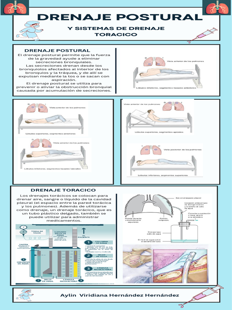 Drenaje Postural | PDF