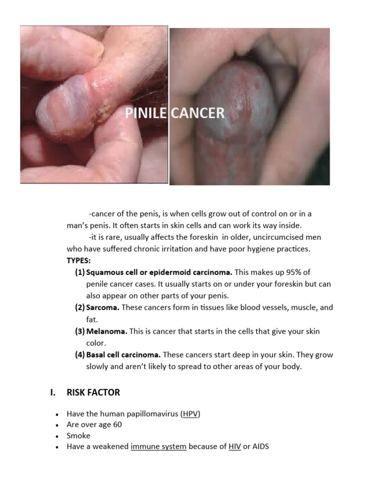 Penile Cancer Pdf Cancer Medical Imaging