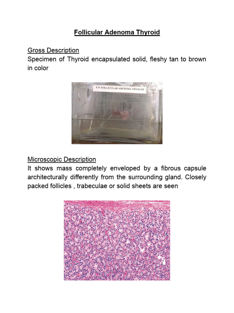 Specimens | PDF | Thyroid | Medical Specialties