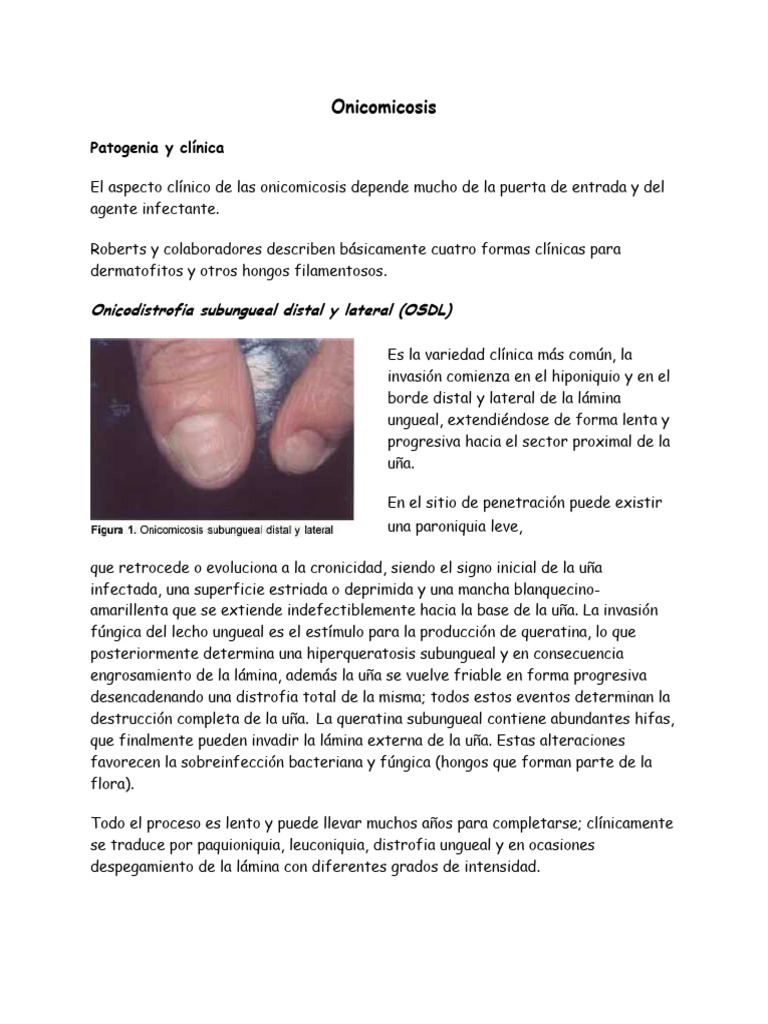 Onicomicosis | PDF | Clavo (anatomía) | Enfermedades y trastornos