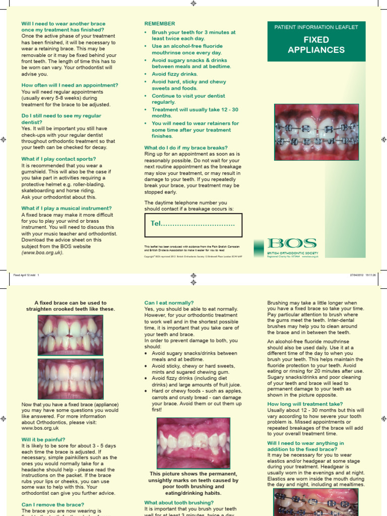 Fixed Metal Brochure | PDF | Orthodontics | Medical Specialties
