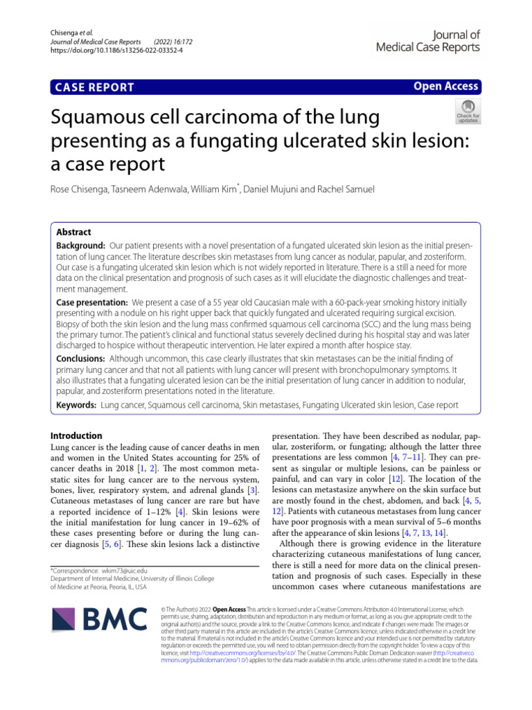 Squamous Cell Carcinoma of The Lung Presenting As A Fungating Ulcerated ...