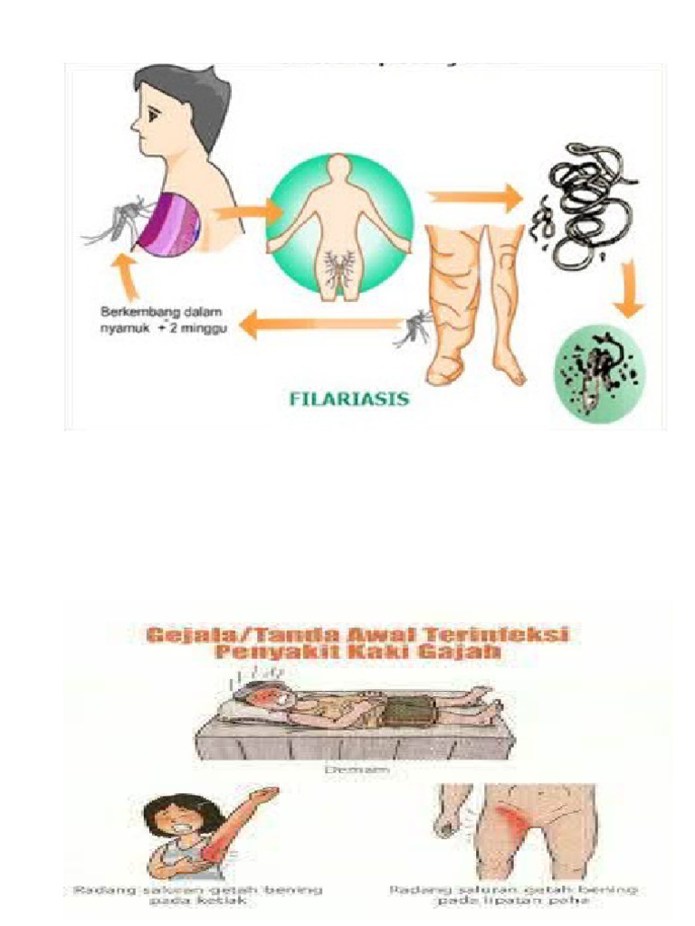 gambar filariasis | PDF
