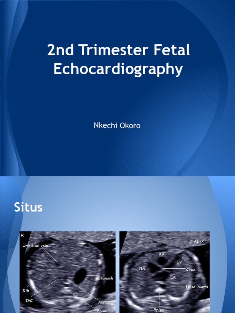 Fetal Echo | PDF