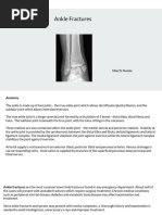 The Radiology Assistant - Ankle Fracture - Weber and Lauge-Hansen ...