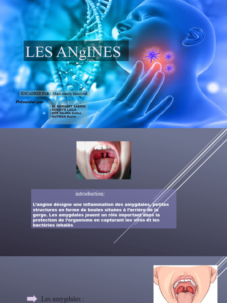 Les Angines | PDF