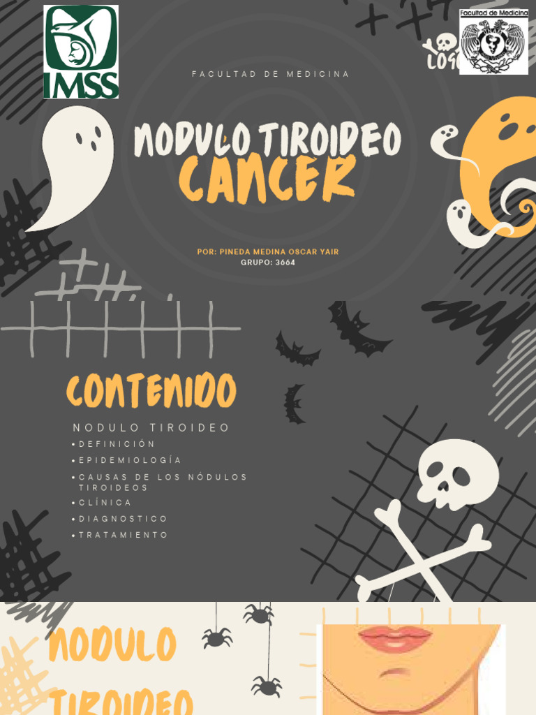 Nodulo Tiroideo | PDF | Especialidades Medicas | Sistema endocrino