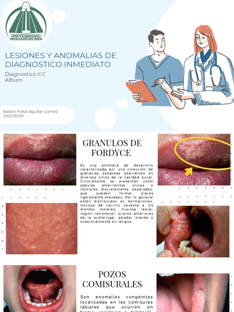 Lesiones Bucales y Gránulos de Fordyce | PDF | Especialidades Medicas ...