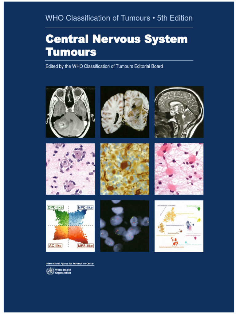 Central Nervous System Tumours: WHO Classification of Tumours - 5th ...