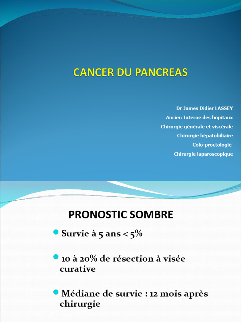 Cancer Du Pancreas | PDF