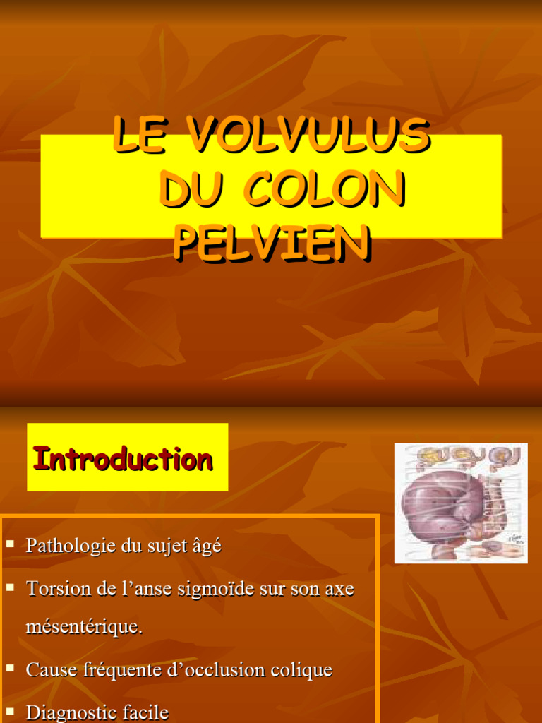 Le Volvulus Du Colon Pelvien | PDF | Gros intestin | Causes de décès