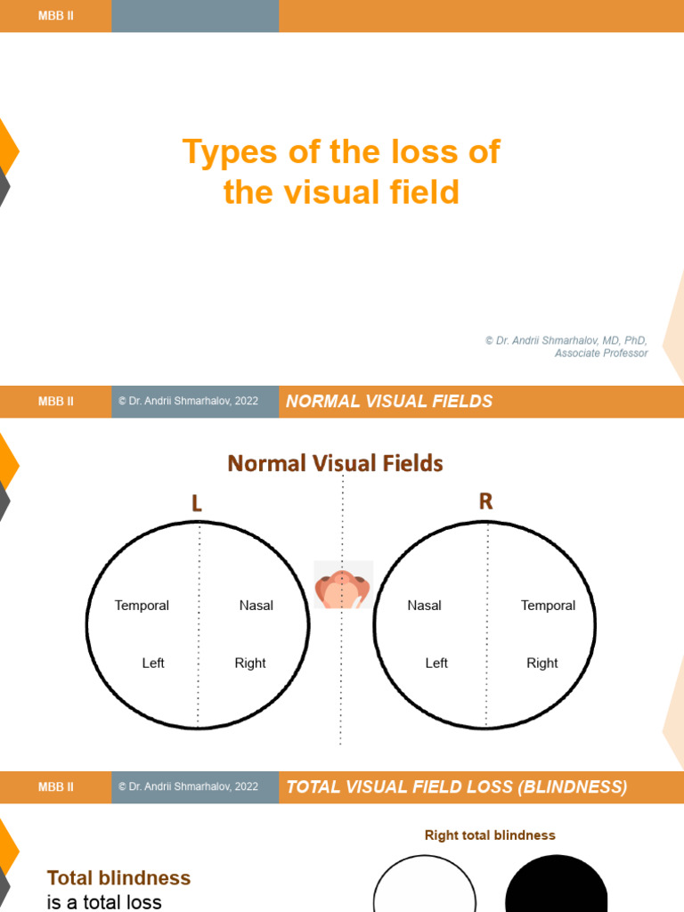 Visual Fields | PDF | Parietal Lobe | Cerebral Cortex