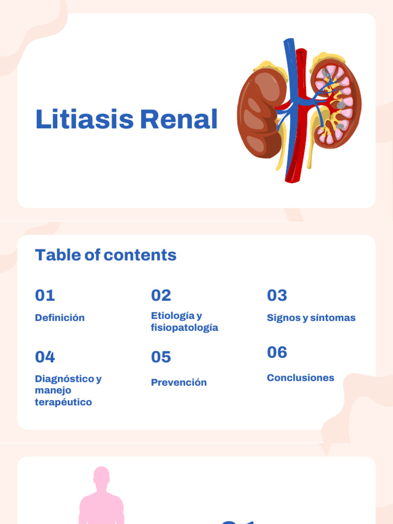 Litiasis Renal Charla | PDF | Medicina CLINICA | Especialidades Medicas
