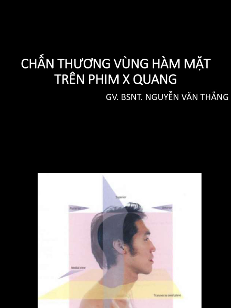 Bản Sao Của Cdha-chấn-thương | PDF