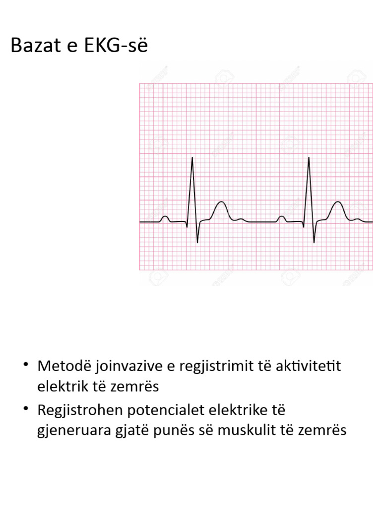 Bazat e EKG-se | PDF