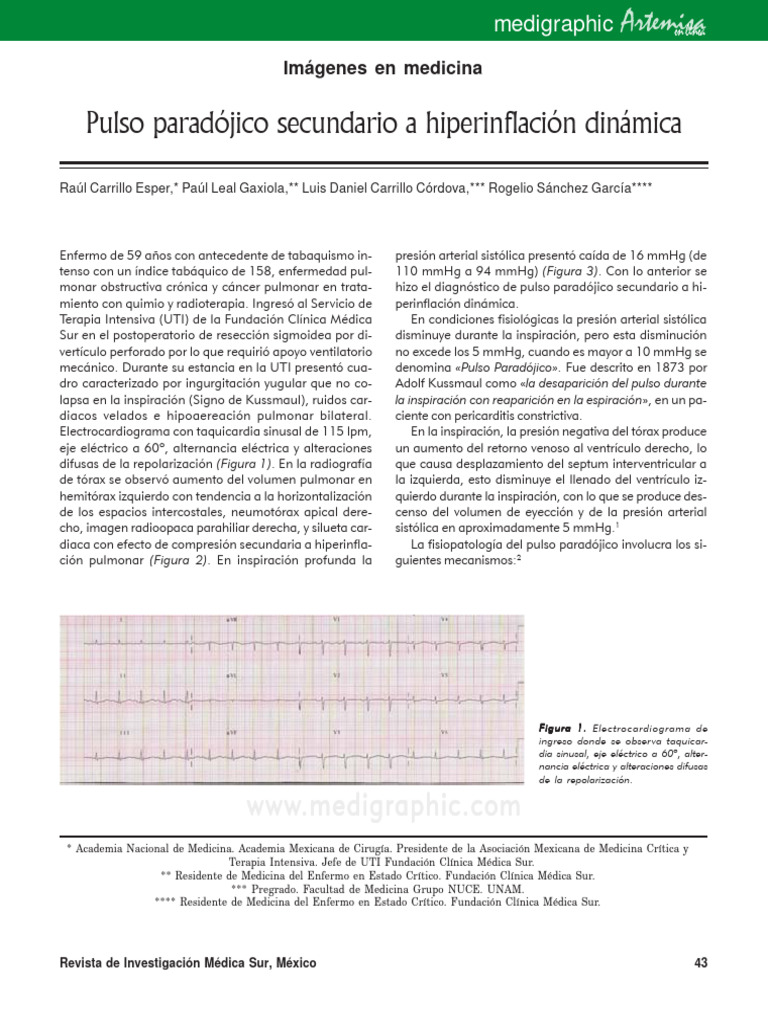 Pulso Paradójico | PDF | Vena | Corazón
