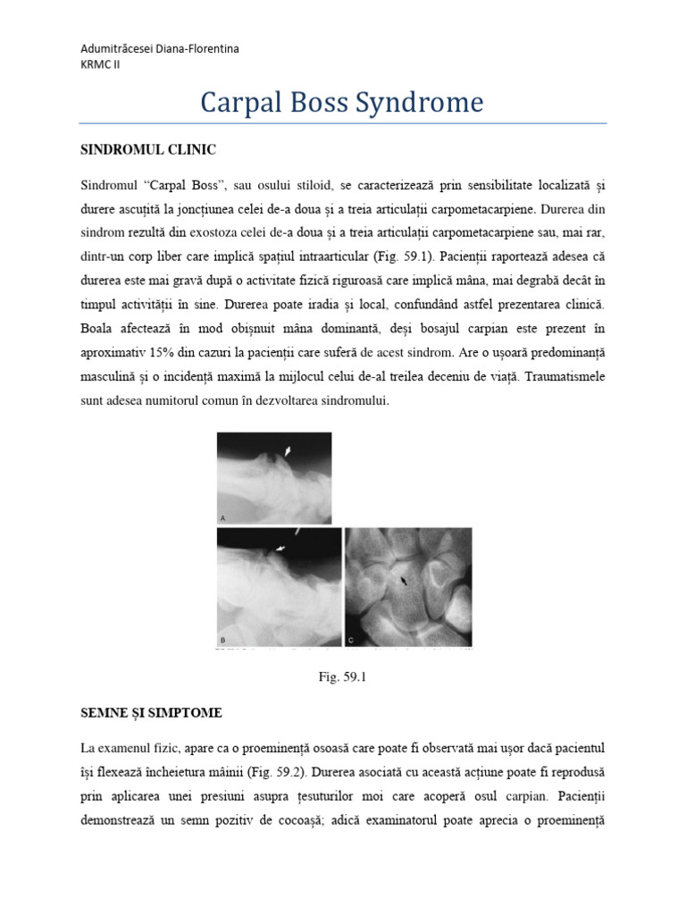 Carpal Boss Syndrome: Sindromul Clinic | PDF