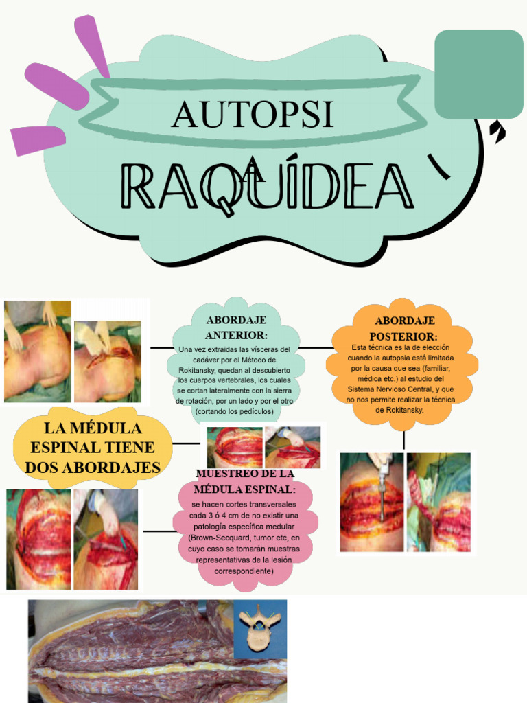 Autopsia Raquidea | PDF