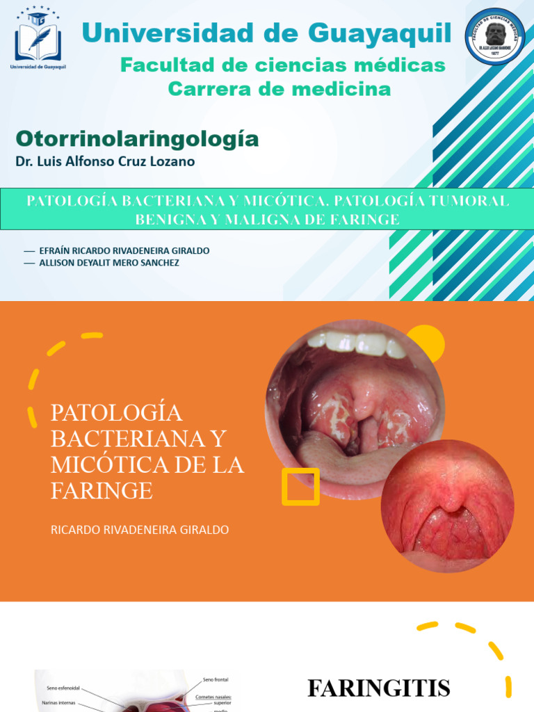 Patologías de Faringe | PDF