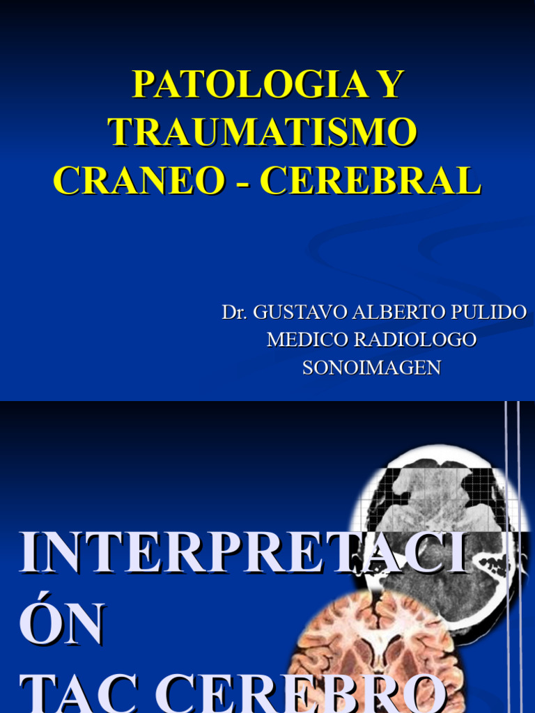 Patologia y Traumatismo Craneal | PDF | Cabeza y cuello humanos ...