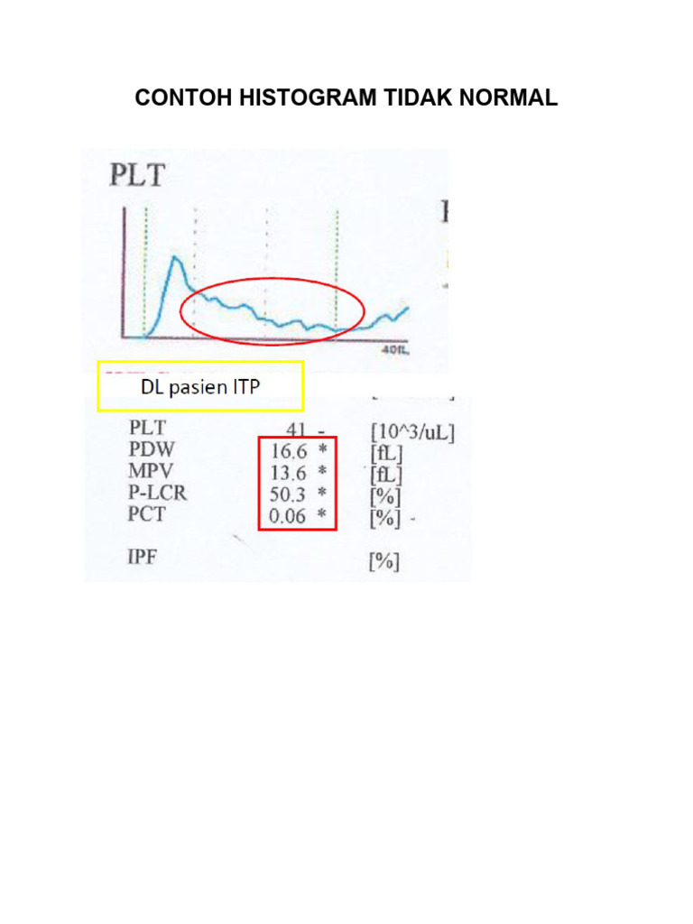 Contoh Abnormal Histogram | PDF