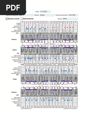 Periodontal Chart Online Derec Online Dental Charting